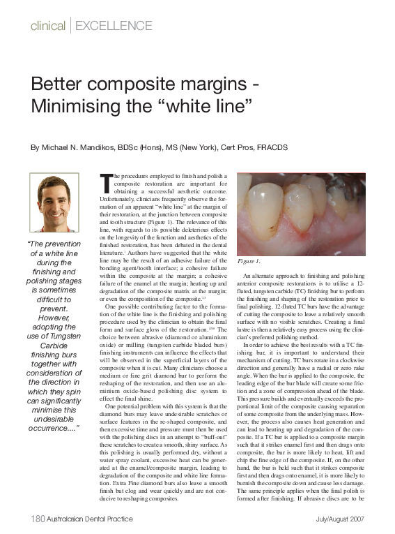 (PDF) Better composite margins-Minimising the “ white line