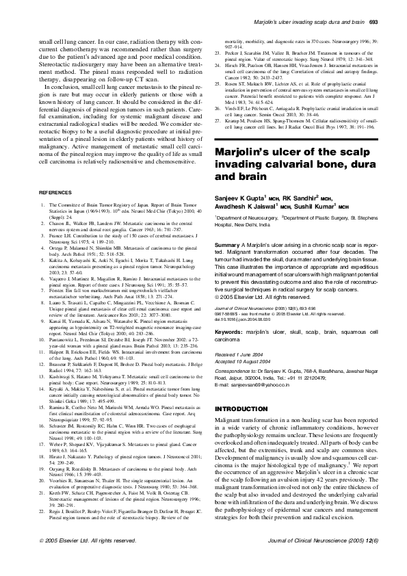 (PDF) Marjolin’s ulcer of the scalp invading calvarial bone, dura and brain