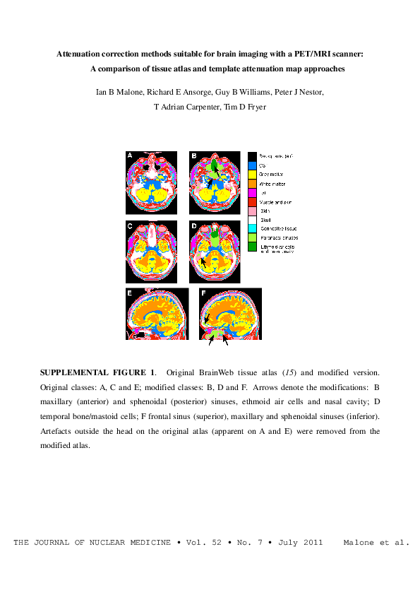 (PDF) Attenuation correction methods suitable for brain imaging with a ...