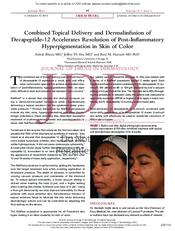 (PDF) Combined topical delivery and dermalinfusion of decapeptide-12 ...