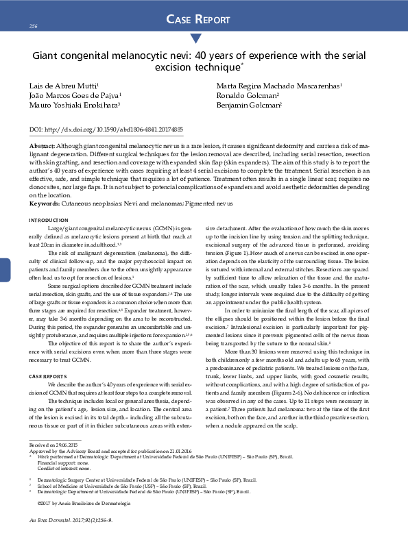 (PDF) Giant congenital melanocytic nevi: 40 years of experience with ...
