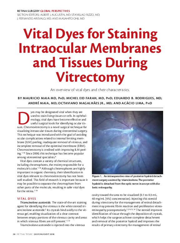 (PDF) Vital Dyes for Staining Intraocular Membranes and Tissues During ...