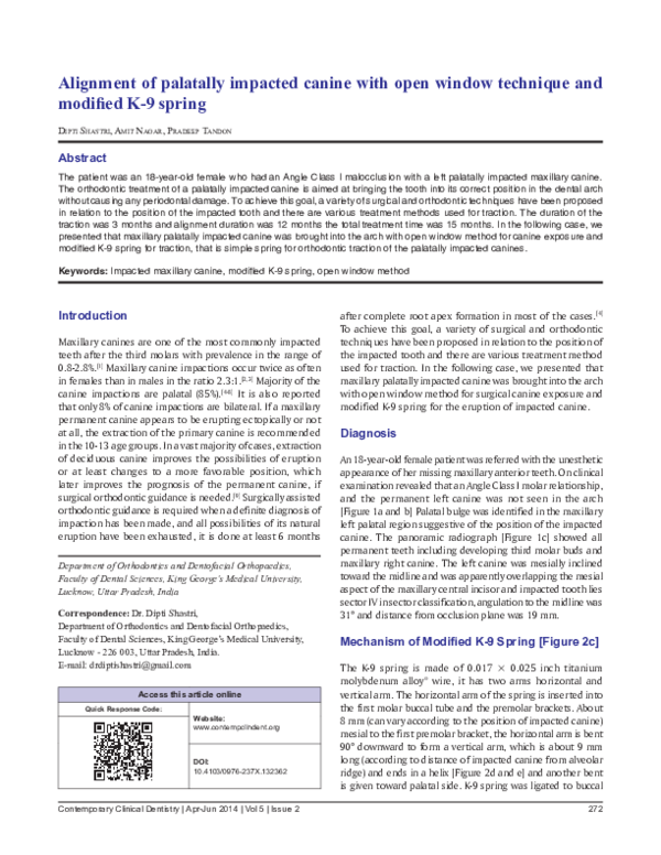 (PDF) Alignment of palatally impacted canine with open window technique ...