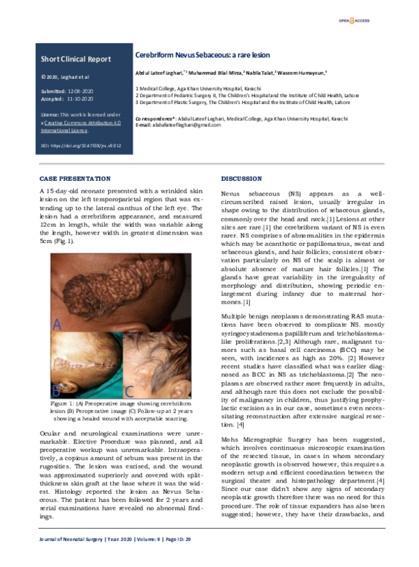 (PDF) Cerebriform Nevus Sebaceous: a rare lesion