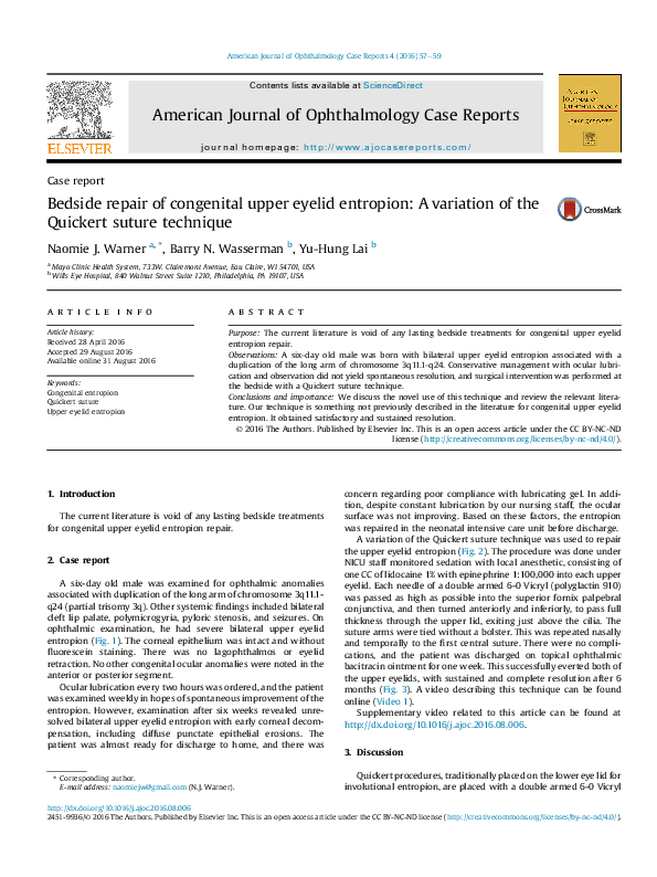 (PDF) Bedside repair of congenital upper eyelid entropion: A variation ...