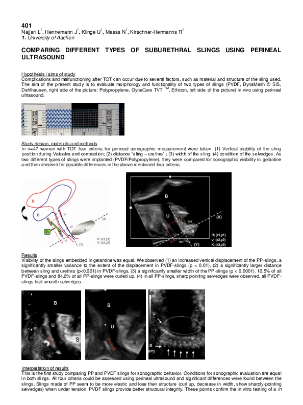 (PDF) Comparing different types of suburethral slings using perineal ...