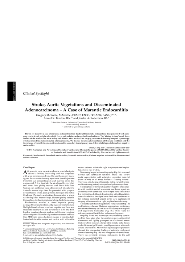 (PDF) Stroke, Aortic Vegetations and Disseminated Adenocarcinoma - A ...