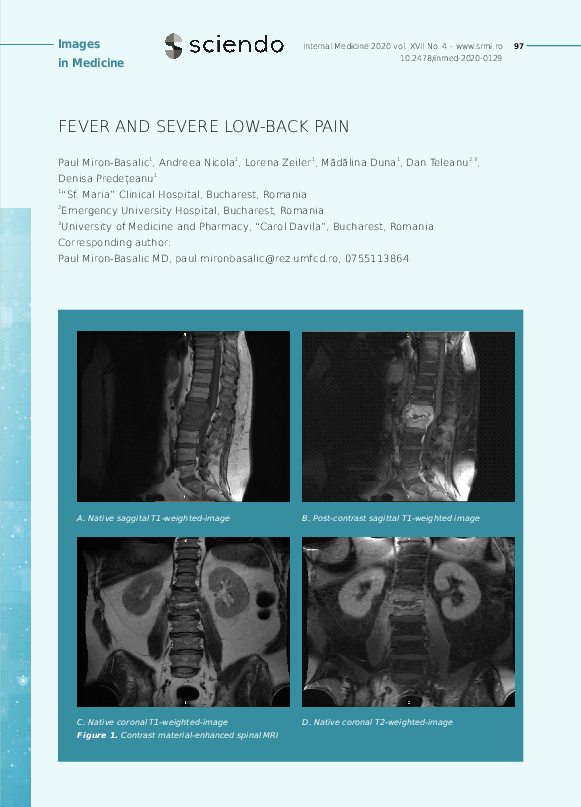 (PDF) Fever and Severe Low-Back Pain