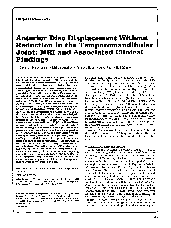 (PDF) Anterior disc displacement without reduction in the ...