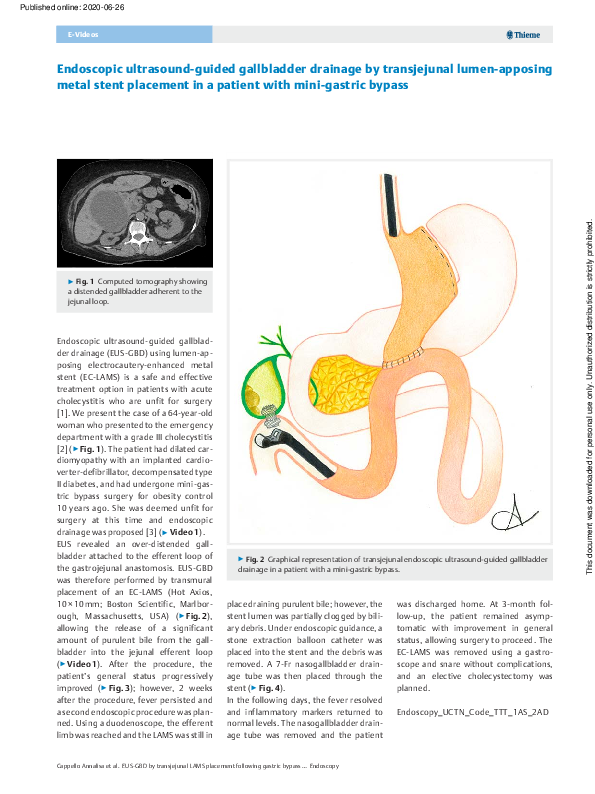 (PDF) Endoscopic ultrasound-guided gallbladder drainage by transjejunal ...