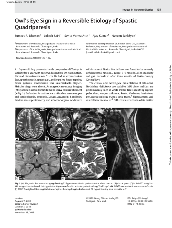 (PDF) Owl's Eye Sign in a Reversible Etiology of Spastic Quadriparesis ...