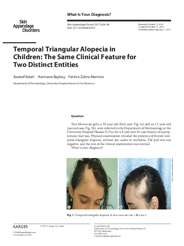 (PDF) Temporal Triangular Alopecia in Children: The Same Clinical ...