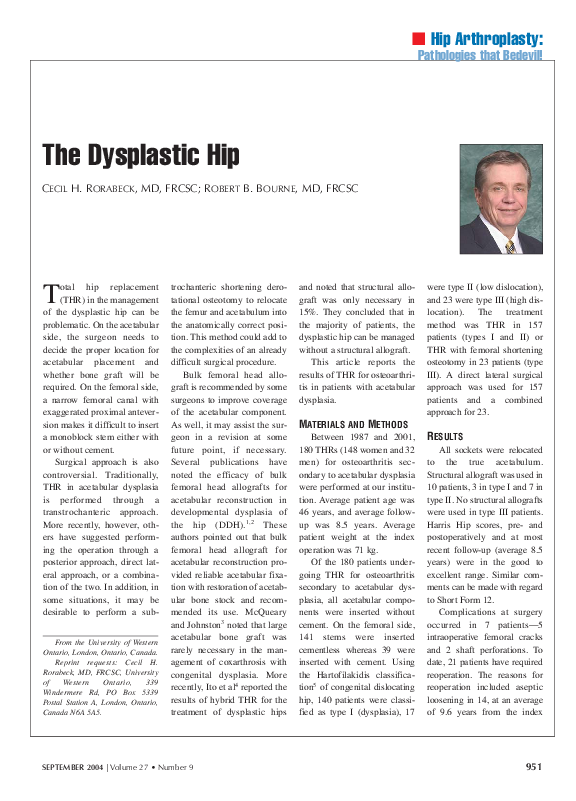 (PDF) The dysplastic hip