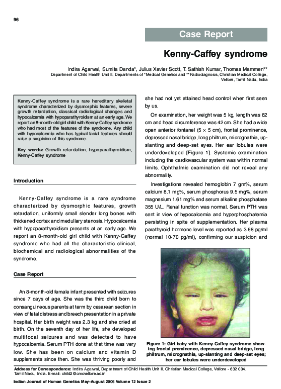 (PDF) Case Report Kenny-Caffey syndrome
