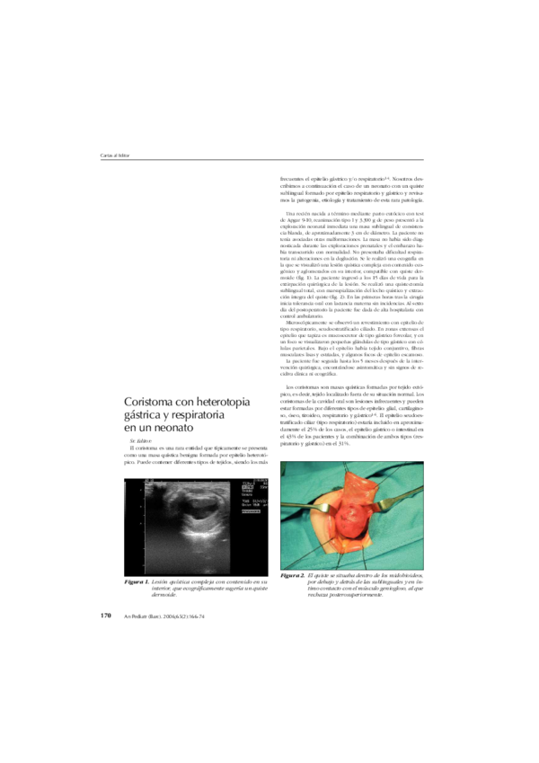 (PDF) Coristoma con heterotopia gástrica y respiratoria en un neonato