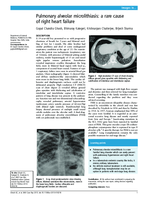(PDF) Pulmonary alveolar microlithiasis: a rare cause of right heart ...