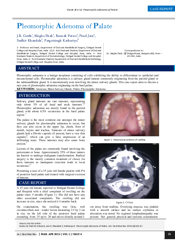 (PDF) Pleomorphic Adenoma of Palate