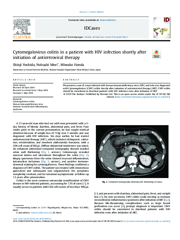 (PDF) Cytomegalovirus colitis in a patient with HIV infection shortly ...