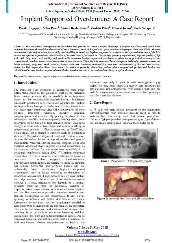 (PDF) Implant Supported Overdenture: A Case Report | Palak Prajapati - Academia.edu