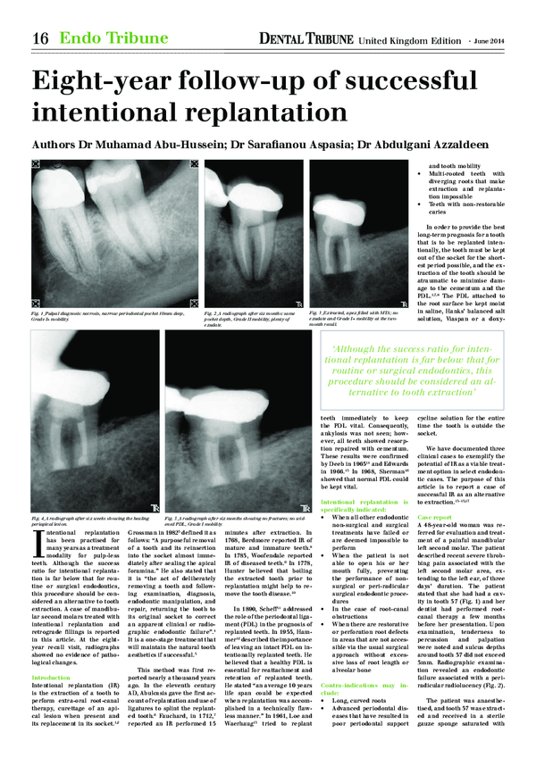 (PDF) Eight-year follow-up of successful intentional replantation