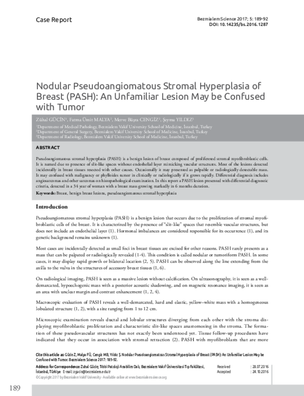 (PDF) Nodular Pseudoangiomatous Stromal Hyperplasia of Breast (PASH ...