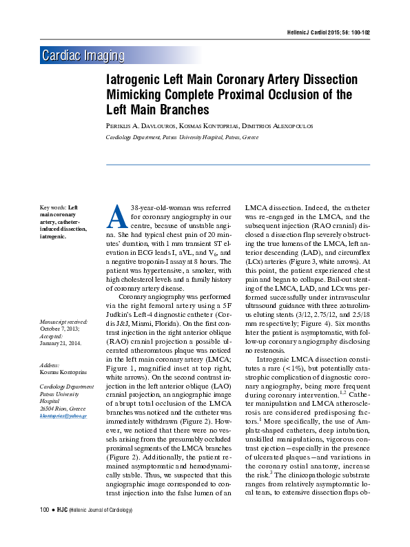 (PDF) Iatrogenic left main coronary artery dissection mimicking ...