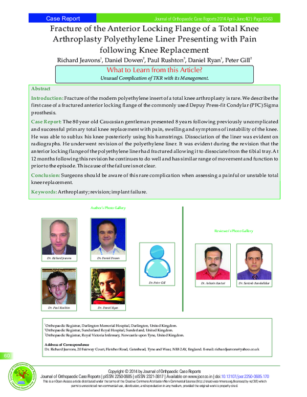 (PDF) Fracture of the Anterior Locking Flange of a Total Knee ...