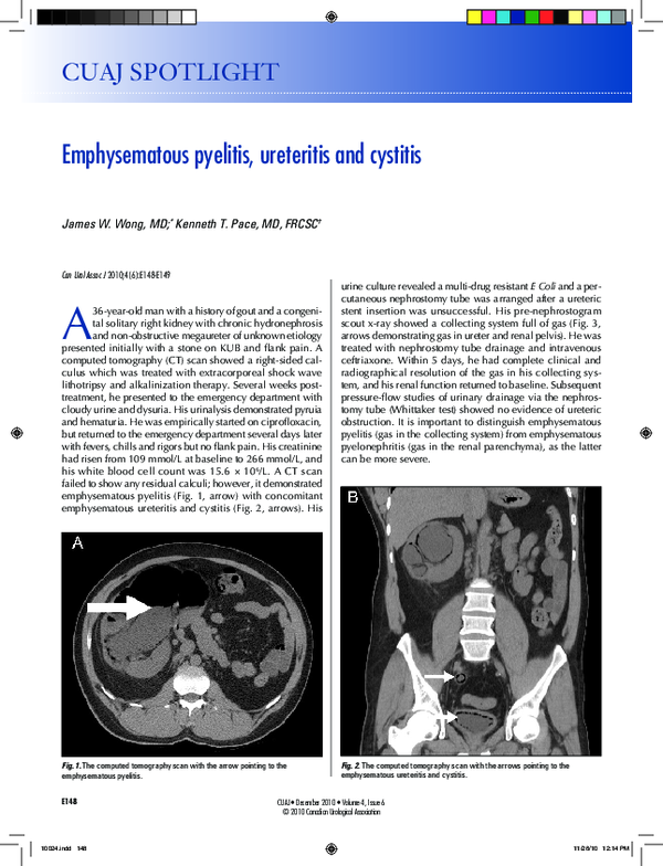 (PDF) Emphysematous pyelitis, ureteritis and cystitis