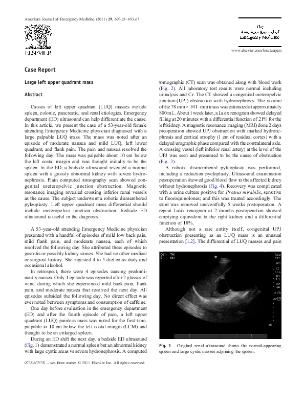 (PDF) Large left upper quadrant mass