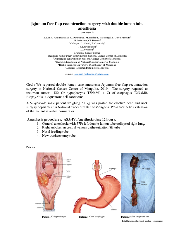 (PDF) Jejunum free flap recontraction surgery with double lumen tube ...