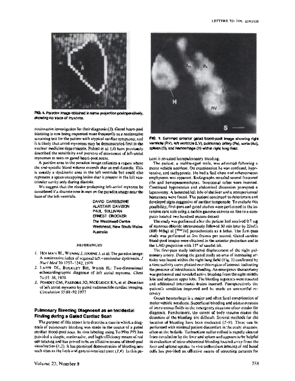 (PDF) Pulmonary Bleeding Diagnosed as an Incidental Finding during a ...