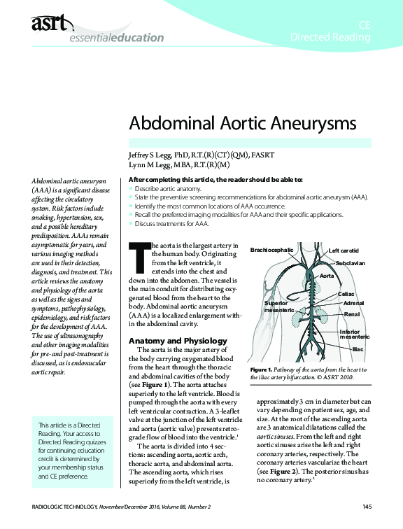 (PDF) Abdominal Aortic Aneurysms