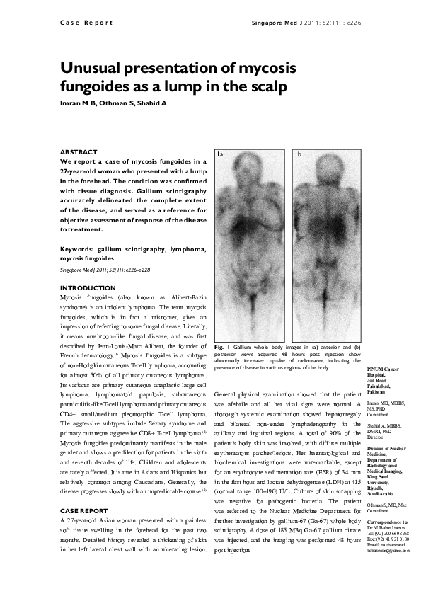 (PDF) Unusual presentation of mycosis fungoides as a lump in the scalp