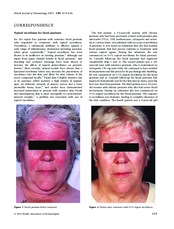 (PDF) Eruptive seborrhoeic keratosis in human immunodeficiency virus ...