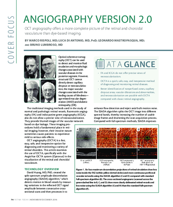 (PDF) CU S OCT angiography offers a more complete picture of the ...