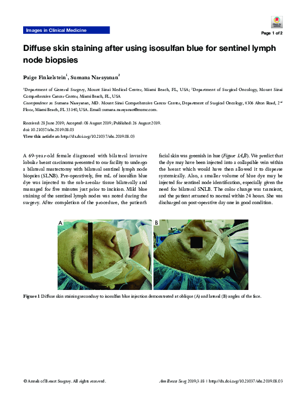 (PDF) Diffuse skin staining after using isosulfan blue for sentinel ...