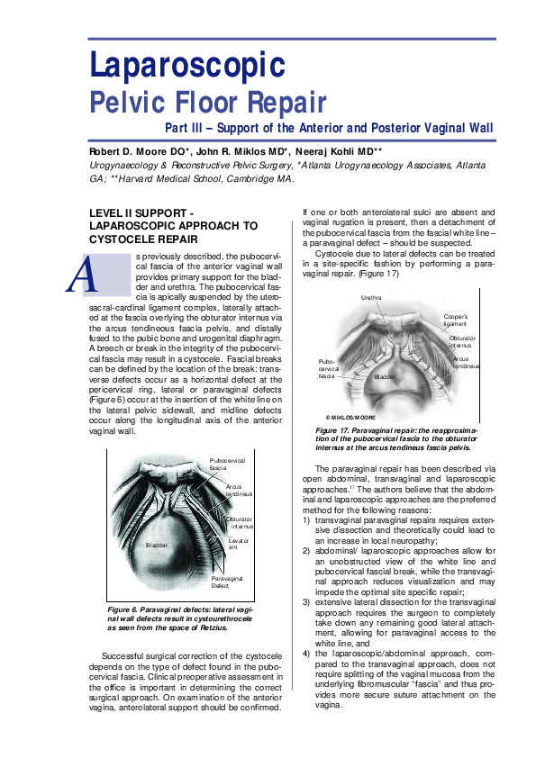 (PDF) A Laparoscopic Pelvic Floor Repair Part III – Support of the ...