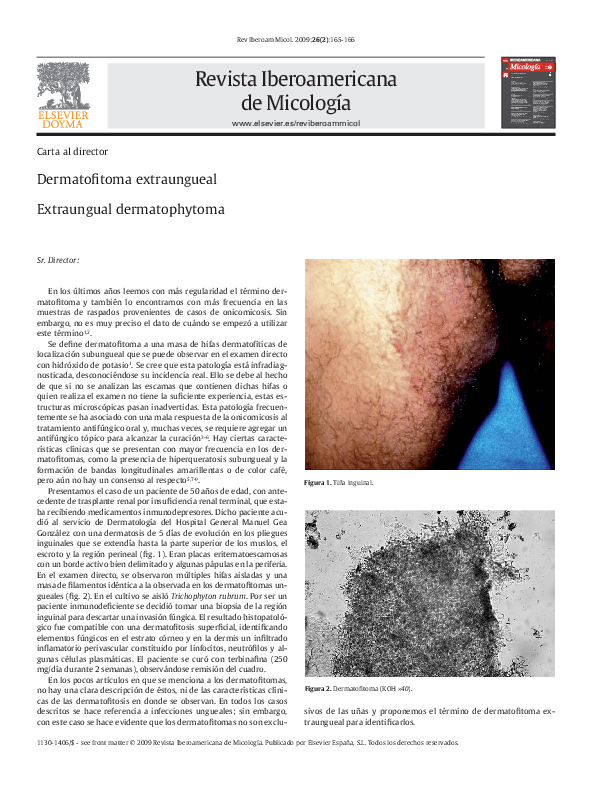 (PDF) Dermatofitoma extraungueal