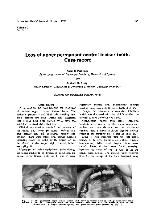 (PDF) Loss of upper permanent central incisor teeth. Case report