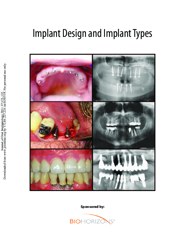 (PDF) Implant Design and Implant Types