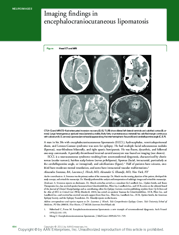 (PDF) Imaging findings in encephalocraniocutaneous lipomatosis