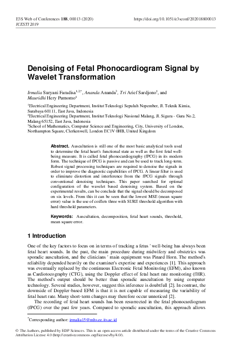 (PDF) Denoising of Fetal Phonocardiogram Signal by Wavelet Transformation