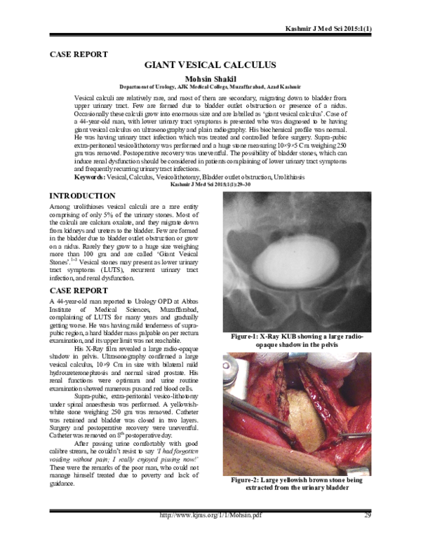 (PDF) Giant Vesical Calculus
