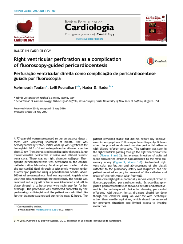 (PDF) Right ventricular perforation as a complication of fluoroscopy ...