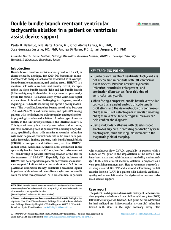 (PDF) Double Bundle Branch Reentrant Ventricular Tachycardia Ablation ...