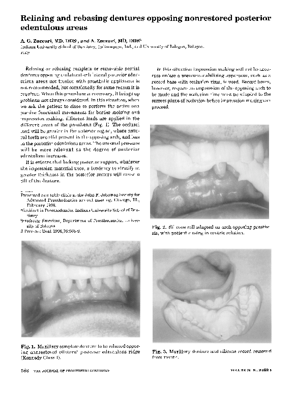 (PDF) Relining and rebasing dentures opposing nonrestored posterior ...