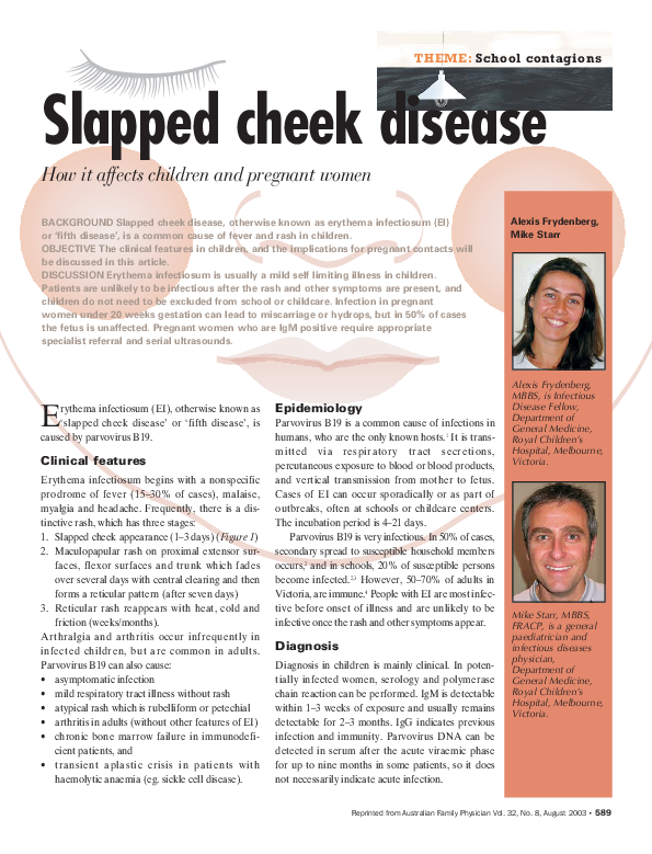 (PDF) Slapped cheek disease How it affects children and pregnant women