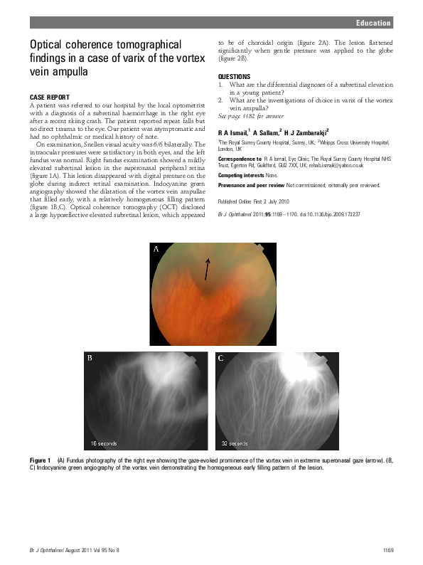 (PDF) Optical coherence tomographical findings in a case of varix of ...