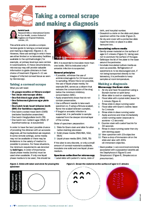 (PDF) Taking a corneal scrape and making a diagnosis