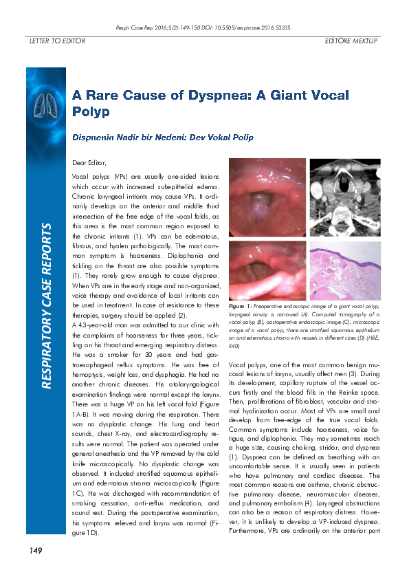 (PDF) Giant Vocal Polyp: An Uncommon Dyspnea Cause